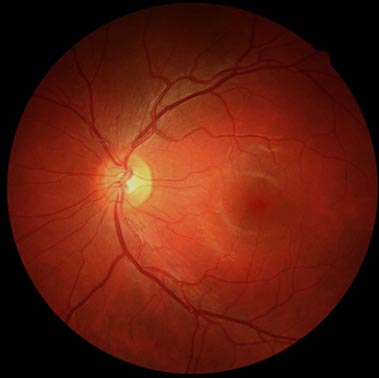 Rétine médicale et chirurgicale